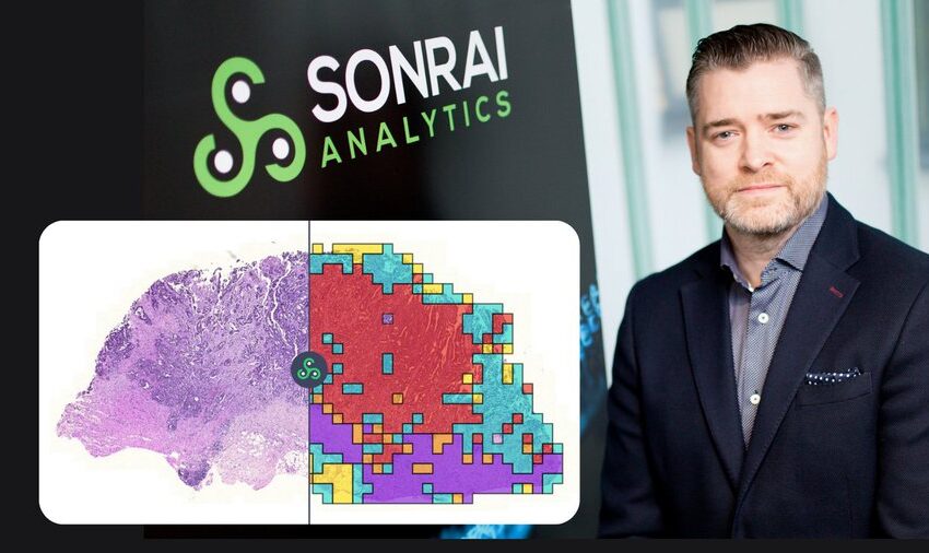 Sonrai Analytics Awarded AI infrastructure to Improve Patient Outcomes ...